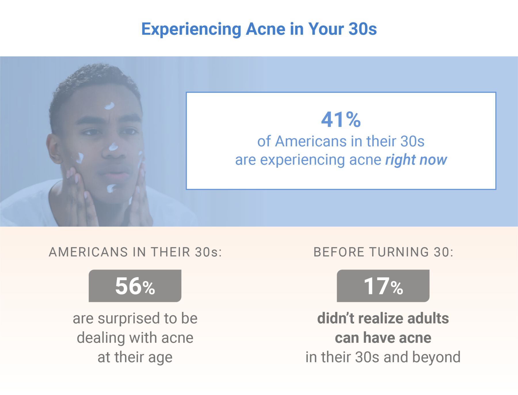 Acne in 30s | Causes and Best Ways to Treat Adult Acne